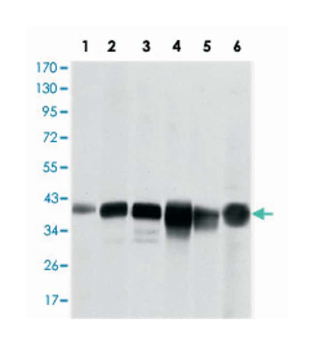 ANTI-SMN1 ANTIBODY 100UL