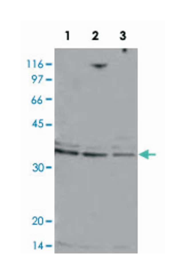TP53BP2, Rabbit, Polyclonal Antibody, Abnova 100μg; Unlabeled:Antibodies, | Fisher Scientific