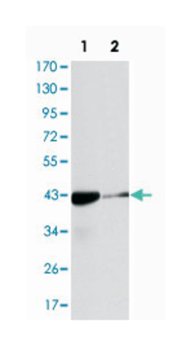 ANTI-ACTA2 ANTIBODY 100UL