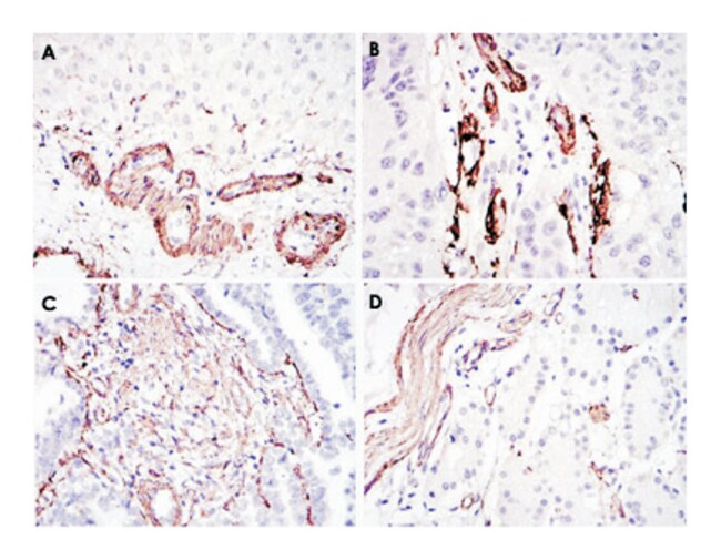 ANTI-ACTA2 ANTIBODY 100UL