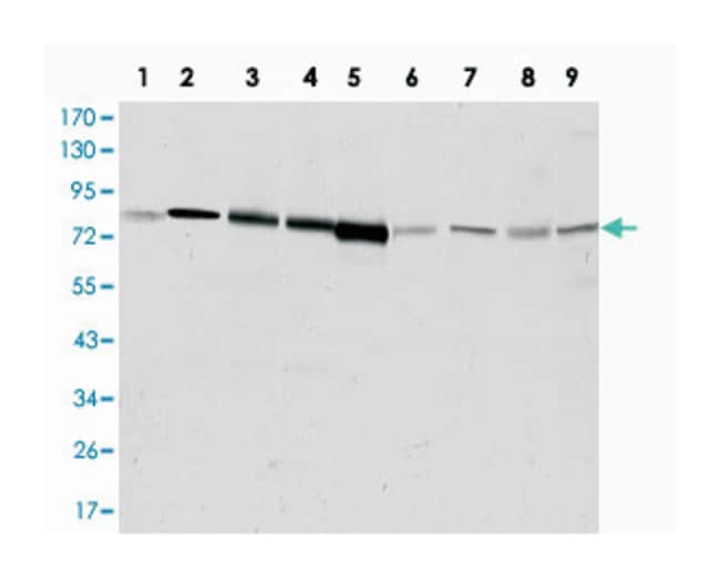 ANTI-ADRBK1 ANTIBODY 100UL