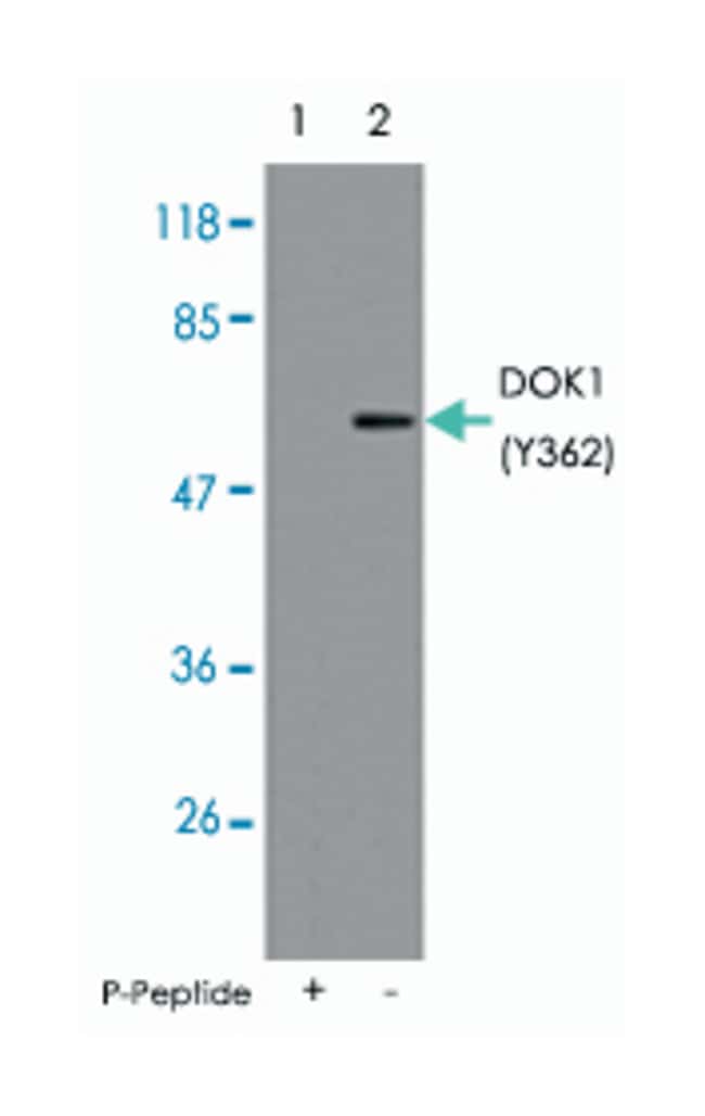 ANTI-DOK1 ANTIBODY 100UG