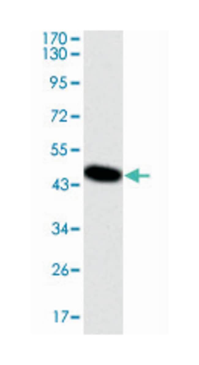 DLK1, Mouse, Clone: 3A10, Abnova 100μL; Unlabeled:Antibodies ...