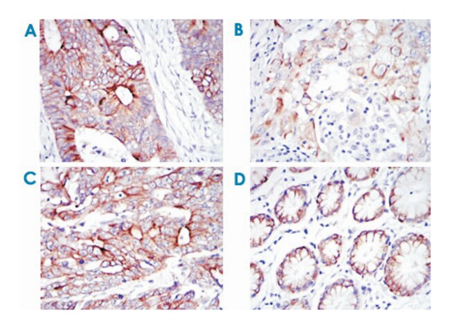 KRT19, Mouse, Clone: 1H6, Abnova 100μL; Unlabeled:Antibodies ...