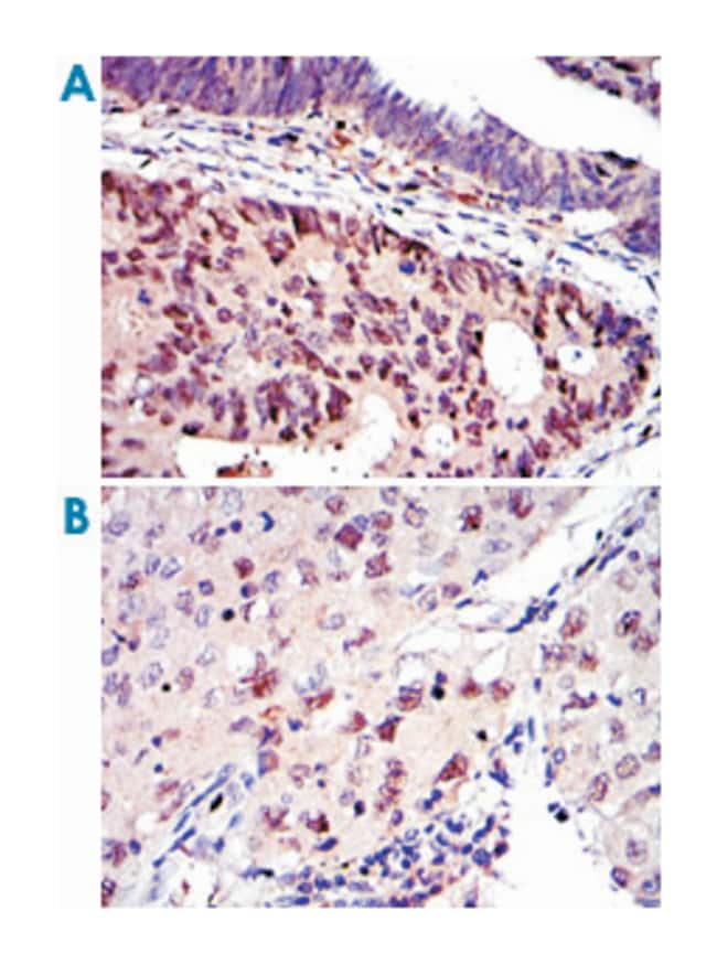 ANTI-MCM2 ANTIBODY 100UL