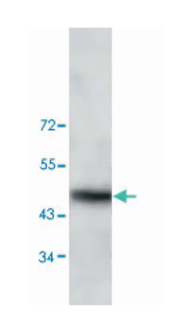Anti Trim13 Antibody 100ug