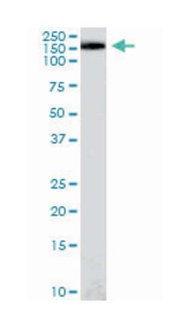 SART3, Goat, Polyclonal Antibody, Abnova 100μg; Unlabeled:Antibodies ...
