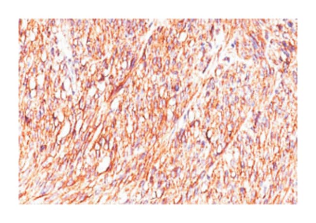 ANTI-ANO1 ANTIBODY 500UL