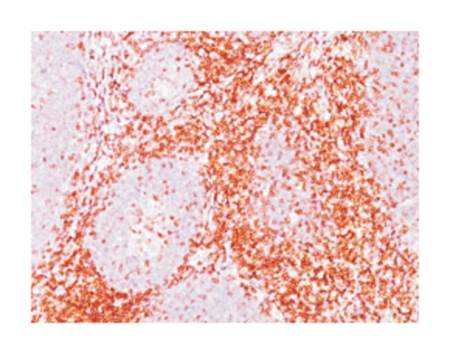 ANTI-CD6 ANTIBODY 100UG