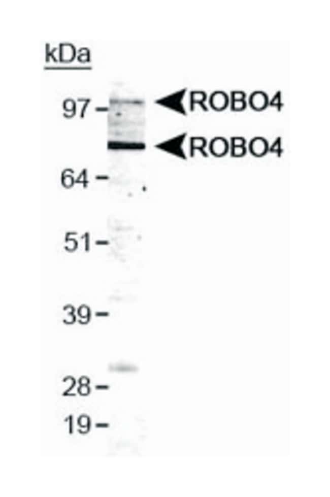 ANTI-ROBO4 ANTIBODY 100UL