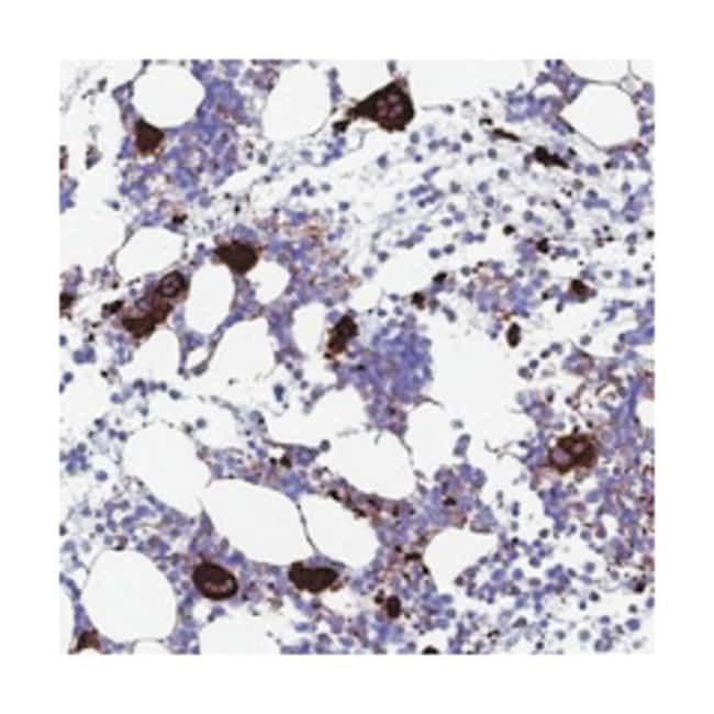 ANTI-PSMD11 ANTIBODY 100UL