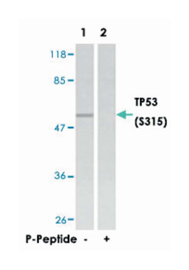 ANTI-TP53 ANTIBODY 100UG