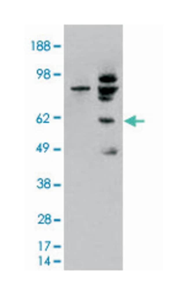 MDM2, Goat, Polyclonal Antibody, Abnova 100μg; Unlabeled:Antibodies ...