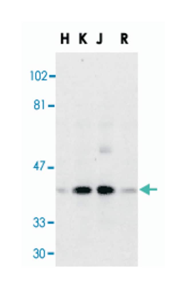 ANTI-DFFB ANTIBODY 100UG