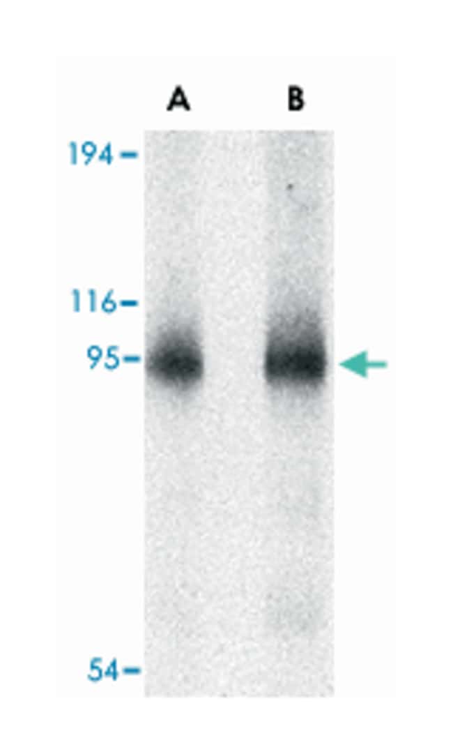 ANTI-CD180 ANTIBODY 100UG