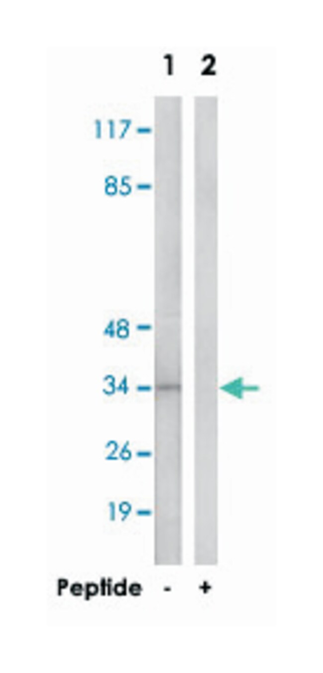 ANTI-FOXR1 ANTIBODY 100UG