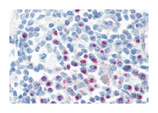 ANTI-CCR4 ANTIBODY 50UG