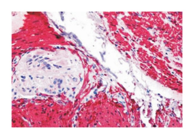 ANTI-GRPR ANTIBODY 50UG