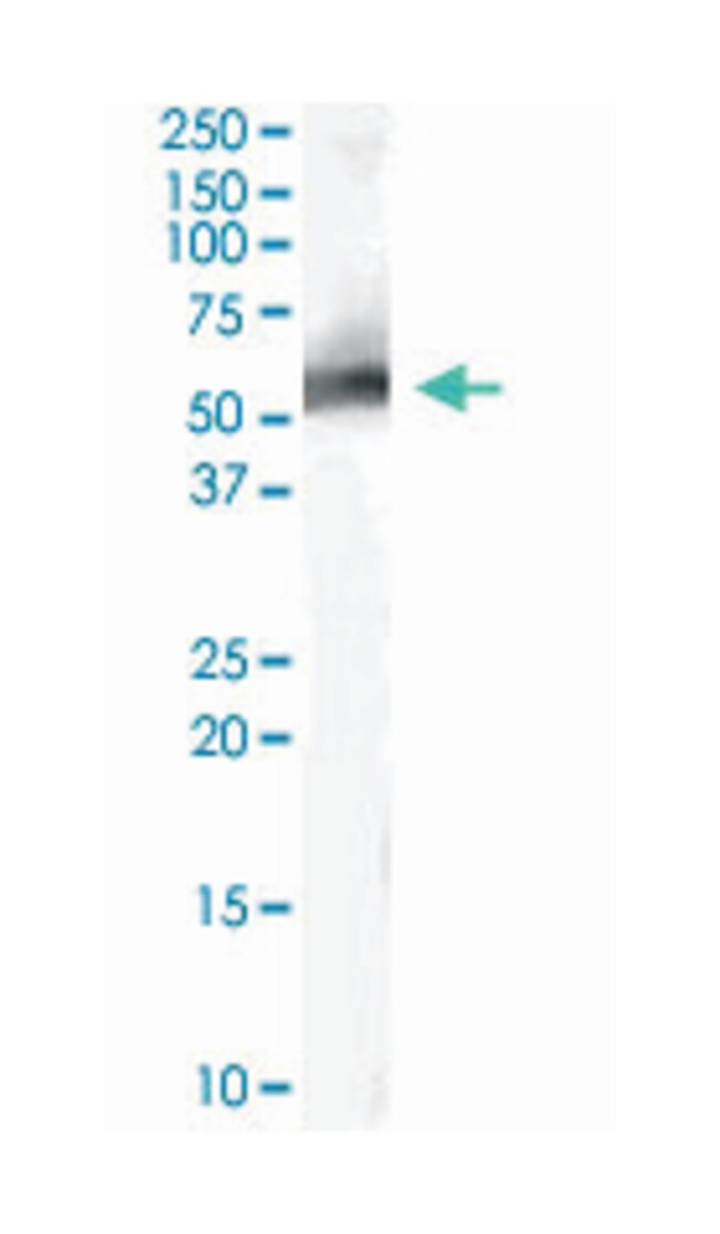 MDM2, Goat, Polyclonal Antibody, Abnova 100μg; Unlabeled:Antibodies ...