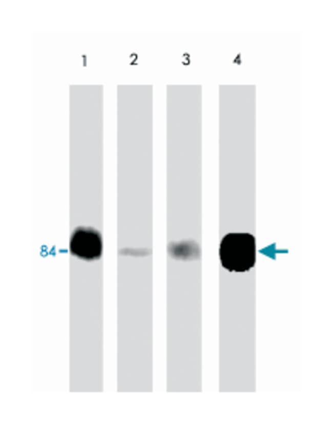 ANTI-JUP ANTIBODY 100UL