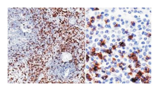 ANTI-SPN ANTIBODY 100UG