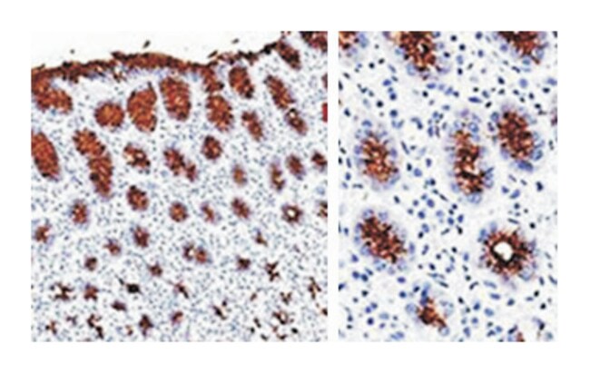 MUC5AC, Mouse, Clone: 45M1, Abnova 100μg; Unlabeled:Anticuerpos ...