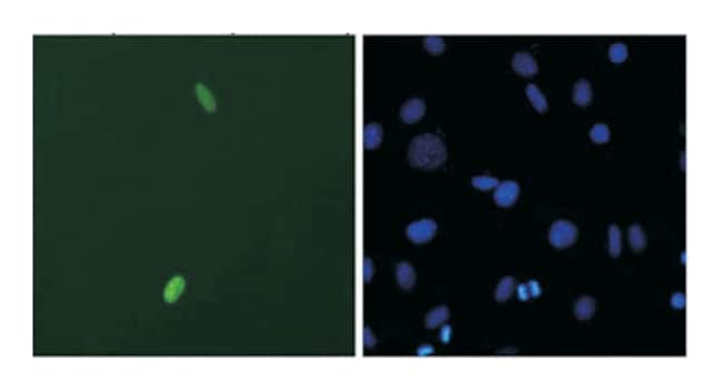 ANTI-DUX4 ANTIBODY 100UG