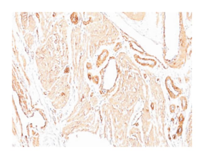 ANTI-ACTA2 ANTIBODY 100UG