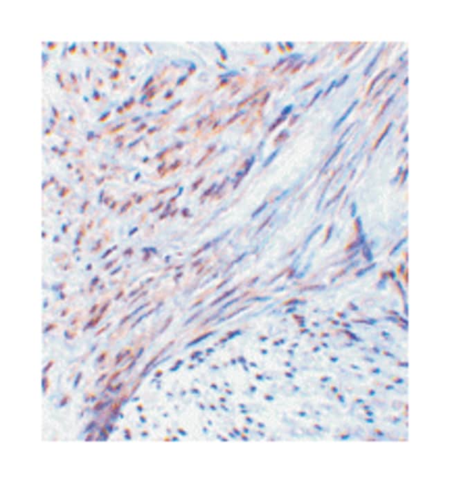 ANTI-TRIM5 ANTIBODY 100UG