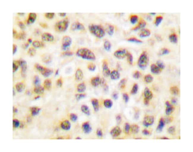 ANTI-TFDP1 ANTIBODY 100UL