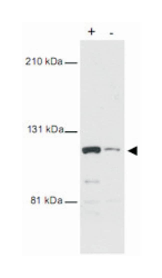 MTBP, Mouse, Clone: PHL-1, Abnova 100μg; Unlabeled:Anticuerpos | Fisher ...