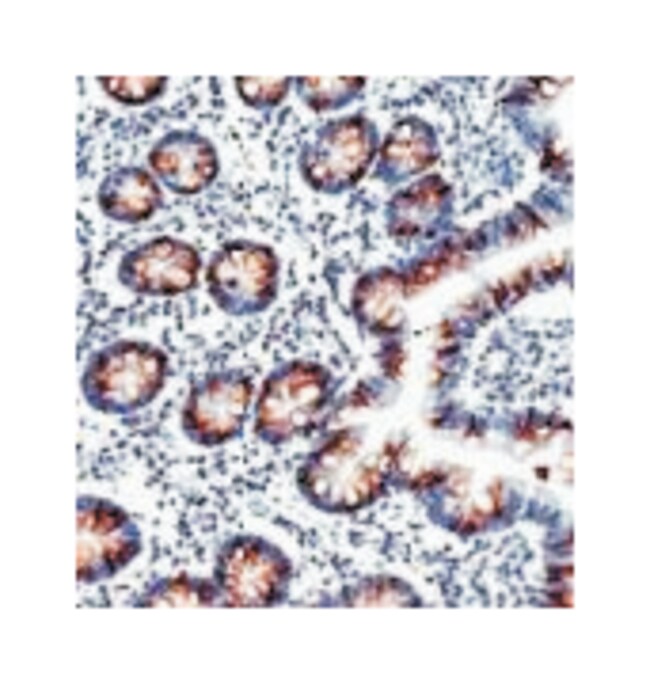 ANTI-MUC2 ANTIBODY 100UL