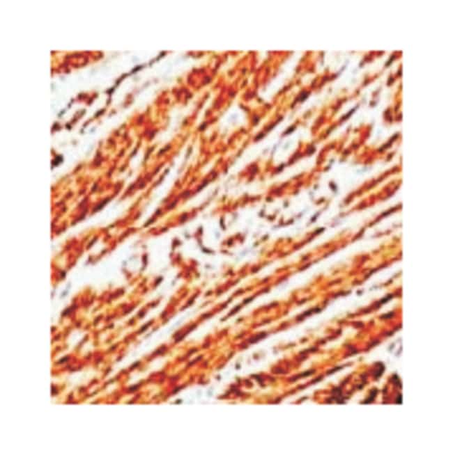 ANTI-ACTA2 ANTIBODY 100UL