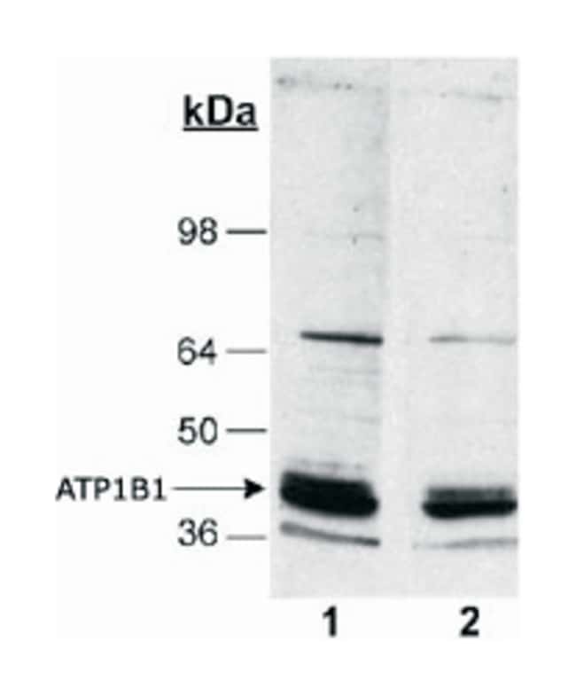 ANTI-ATP1B1 ANTIBODY 100UL