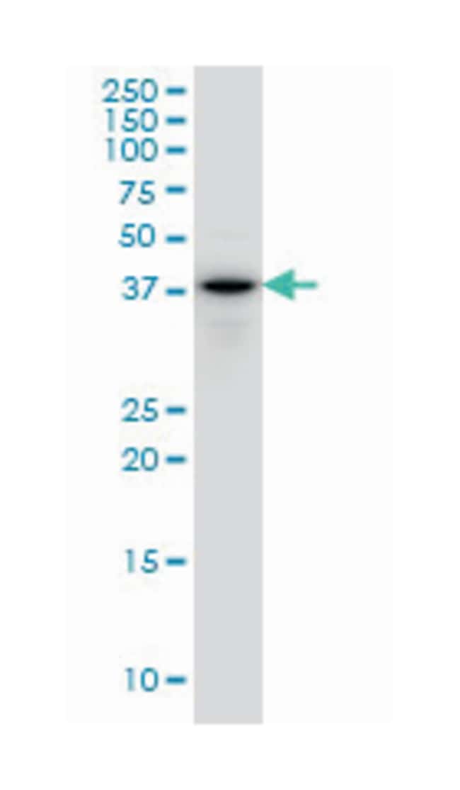 cytohesin 2, Mouse, Clone: 6H5, Abnova™ 100μg; Unlabeled | Fisher ...