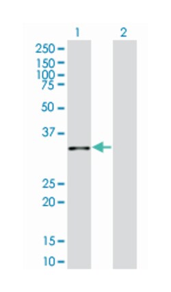 annexin A10, Mouse, Polyclonal Antibody, Abnova 50μL; Unlabeled ...