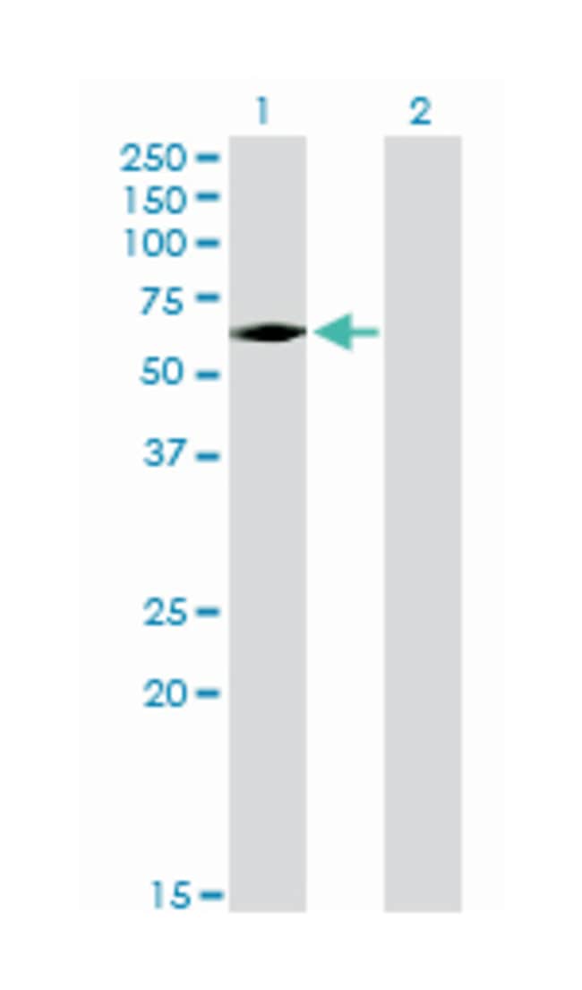 ANTI-IRAK3 (1F6) 100UG