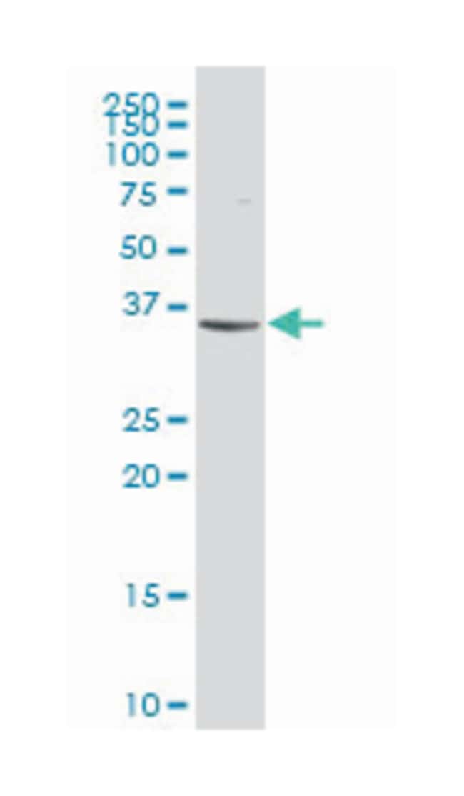 ANTI-B3GAT3 PAB 50UL