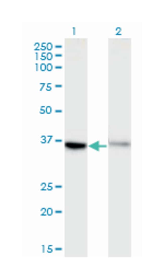 ANTI-GPR84 (1D9) 100UG