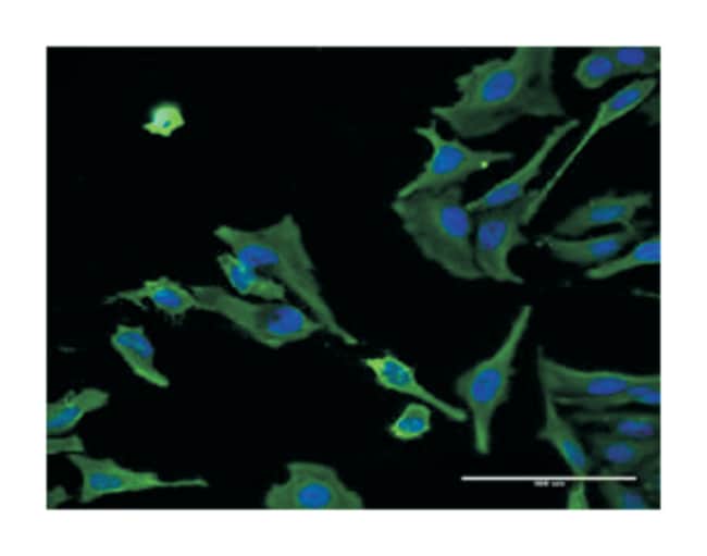 ANTI-ALS2 (4F10) 100UG