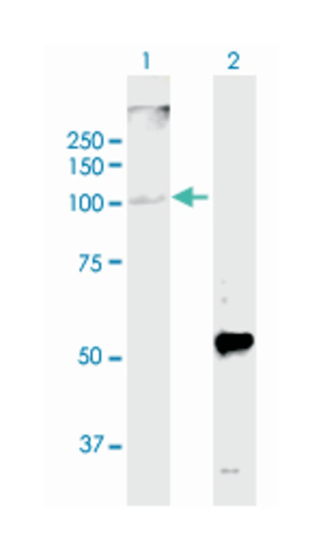 ANTI-GPAM MAXPAB 50UG