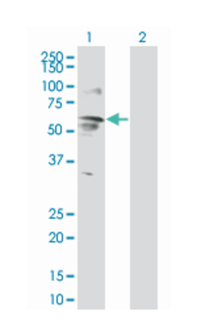 ectonucleotide pyrophosphatase/phosphodiesterase 5 (putative function ...