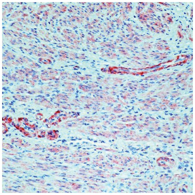 Myosin Smooth Muscle Heavy Chain Monoclonal Antibody, Clone: SMMS-1 ...