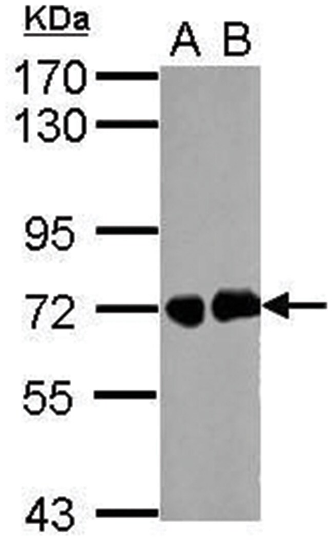 Helicobacter pylori urease B, Polyclonal, Invitrogen 100µL; Unconjugated