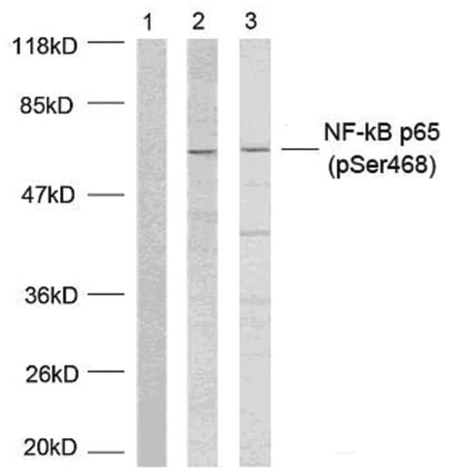 Phospho-NFkB p65 (Ser468), Polyclonal, Invitrogen 100µL; Unconjugated