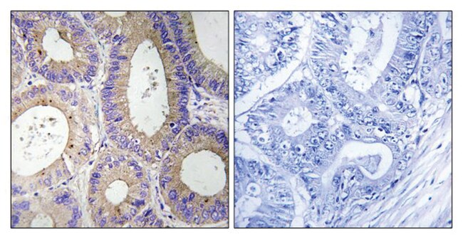 CBR3, Polyclonal, Invitrogen 100µg; Unconjugated