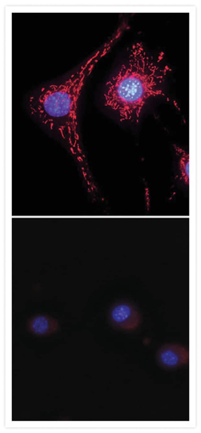 Invitrogen Molecular Probes MitoSOX Red Mitochondrial Superoxide ...