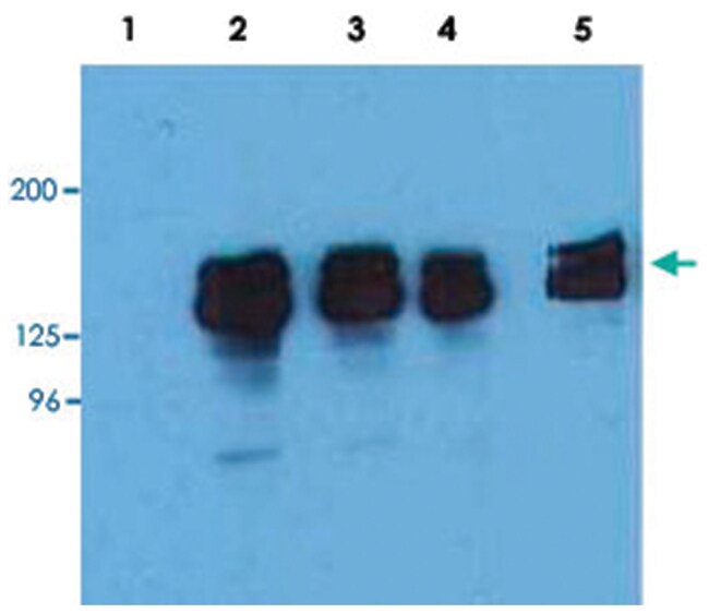 INPP5D, Mouse, Clone: SHIP-01, Abnova™ 100μg; Unlabeled | Fisher Scientific