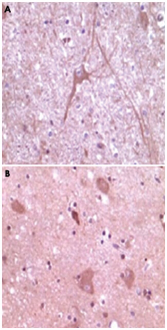 DNM2 Mouse anti-Human, Clone: 5E4C2F3, Abnova 50μL; Unlabeled ...