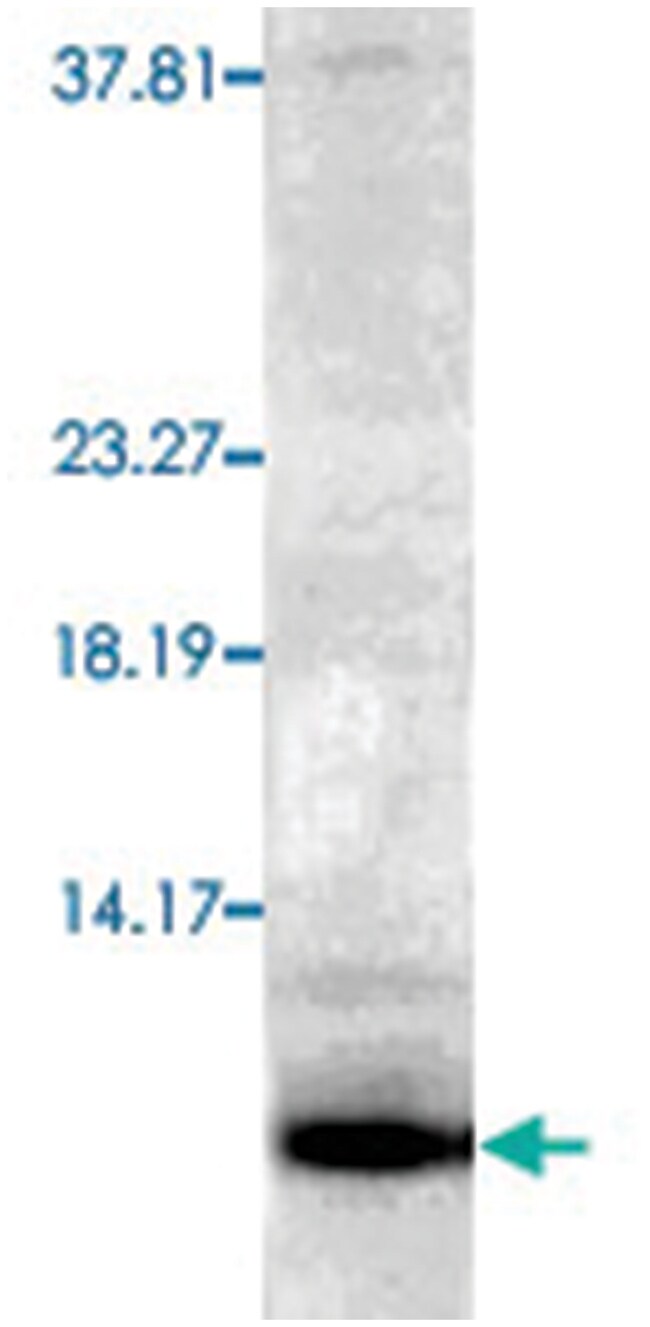 Ubiquitin, Mouse, Clone: 6C11-B3, Abnova 200μg; Unlabeled:Antibodies ...